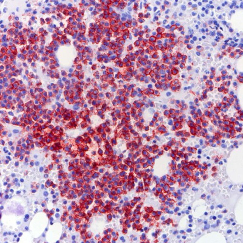 OSTEOSOFT® Mild Decalcifier-solution for Histology - Labchem Catalog